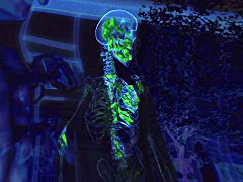 The Daily Smallville 01:04 X-ray – The Daily Rios